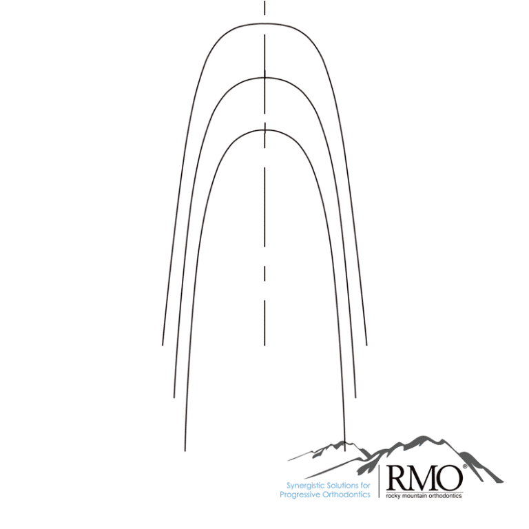 Arco Lingual Universal Niti | RMO - Ortotek