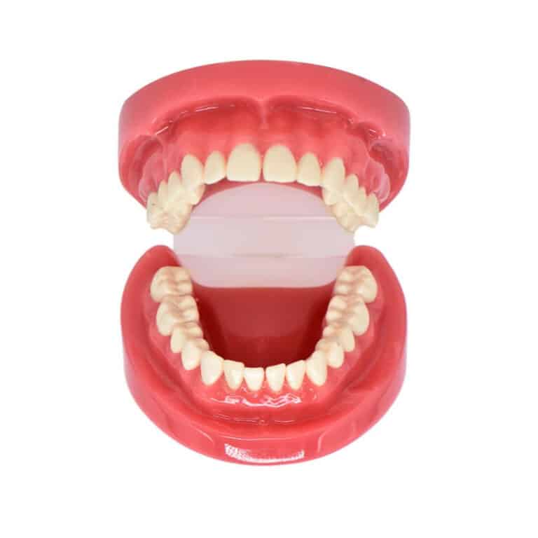 Modelo sin Brackets | DTC - Ortotek