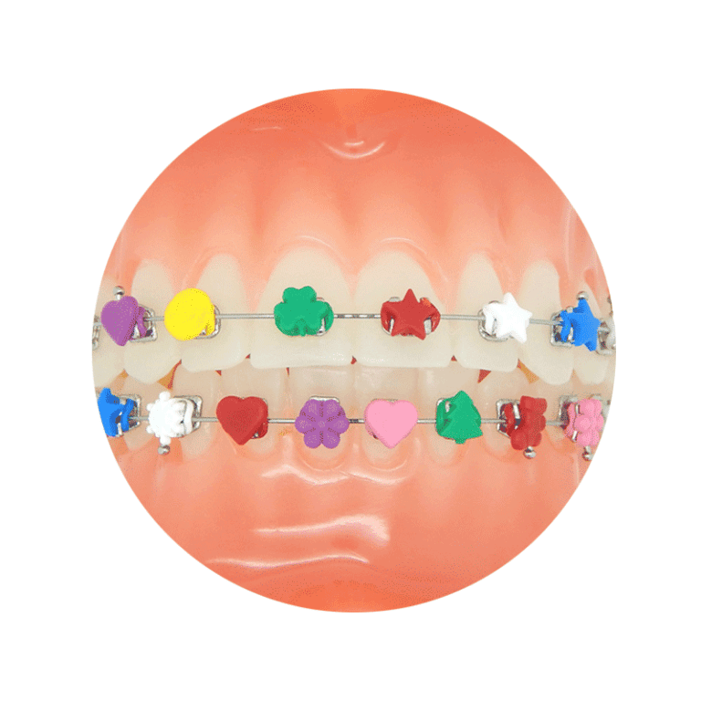 Cadeneta Memory Chain | American Orthodontics - Ortotek