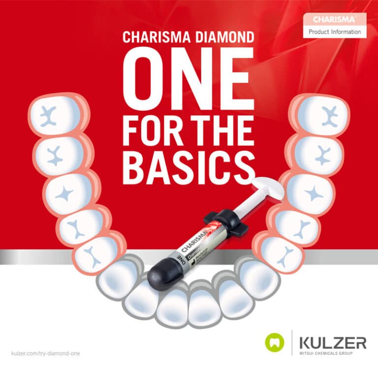 Charisma Diamond ONE 4 gr | Kulzer - Ortotek