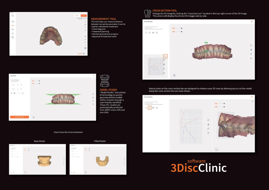 Escáner Intraoral OVO | 3Disc - Ortotek
