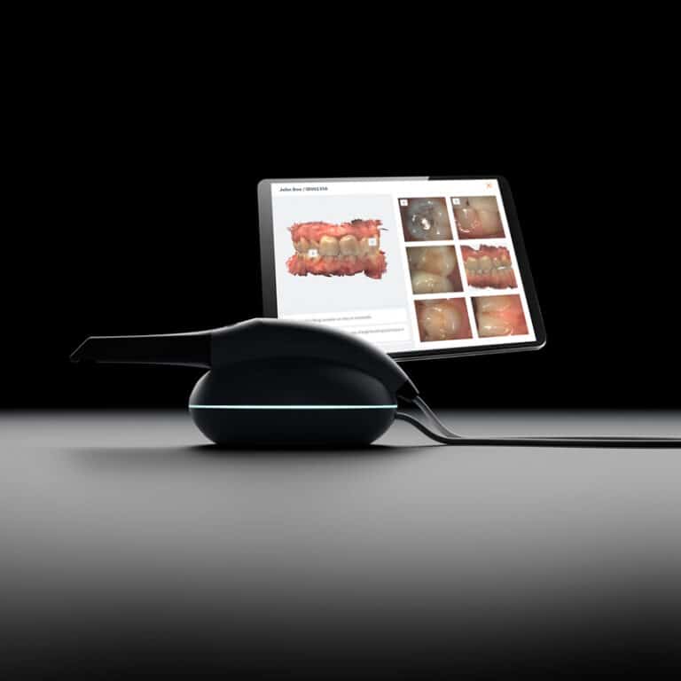 Escáner Intraoral OVO | 3Disc - Ortotek