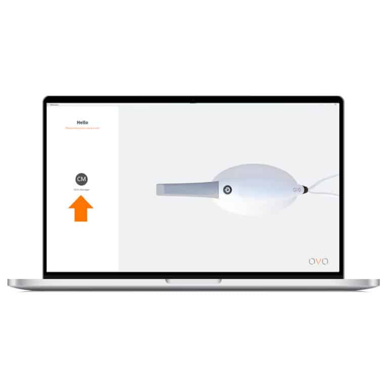 Escáner Intraoral OVO | 3Disc - Ortotek